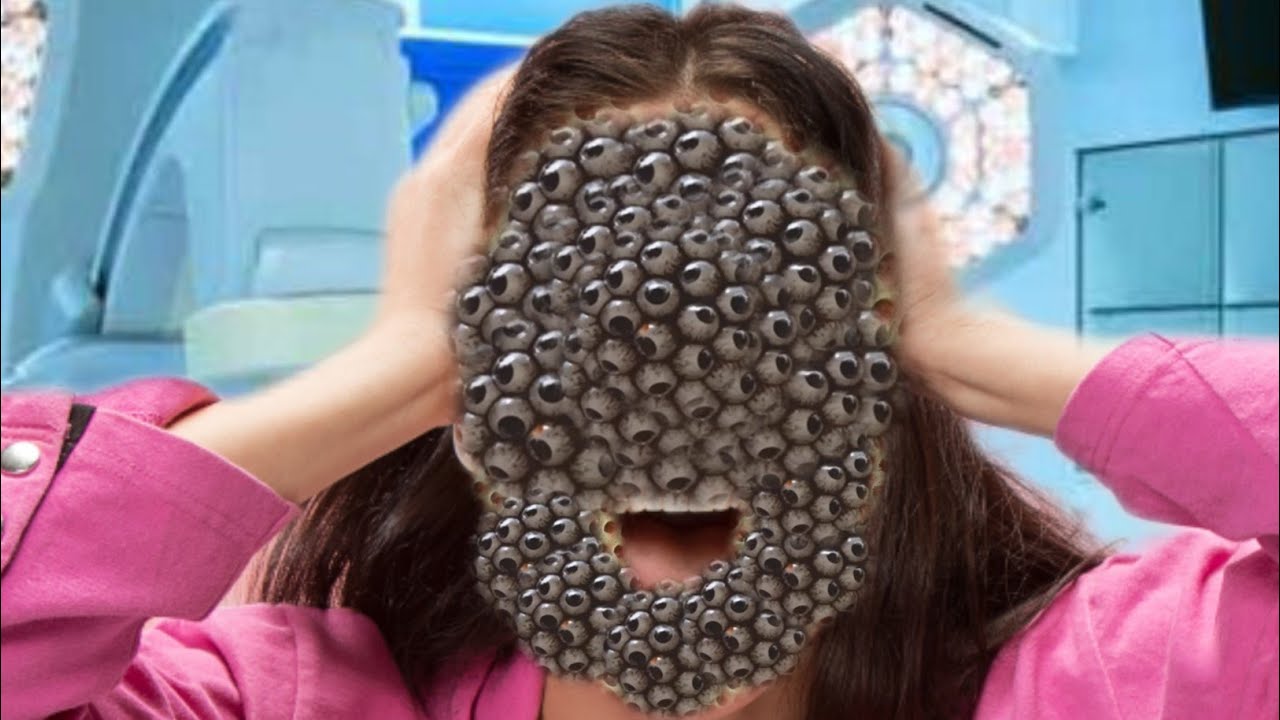 ☺️How to remove trypophobia big surgery infected of face | ASMR ...