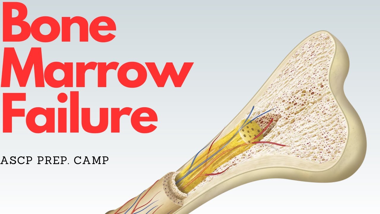 ASCP | MLS | MLT | Hematology | Bone Marrow Failure - YouTube