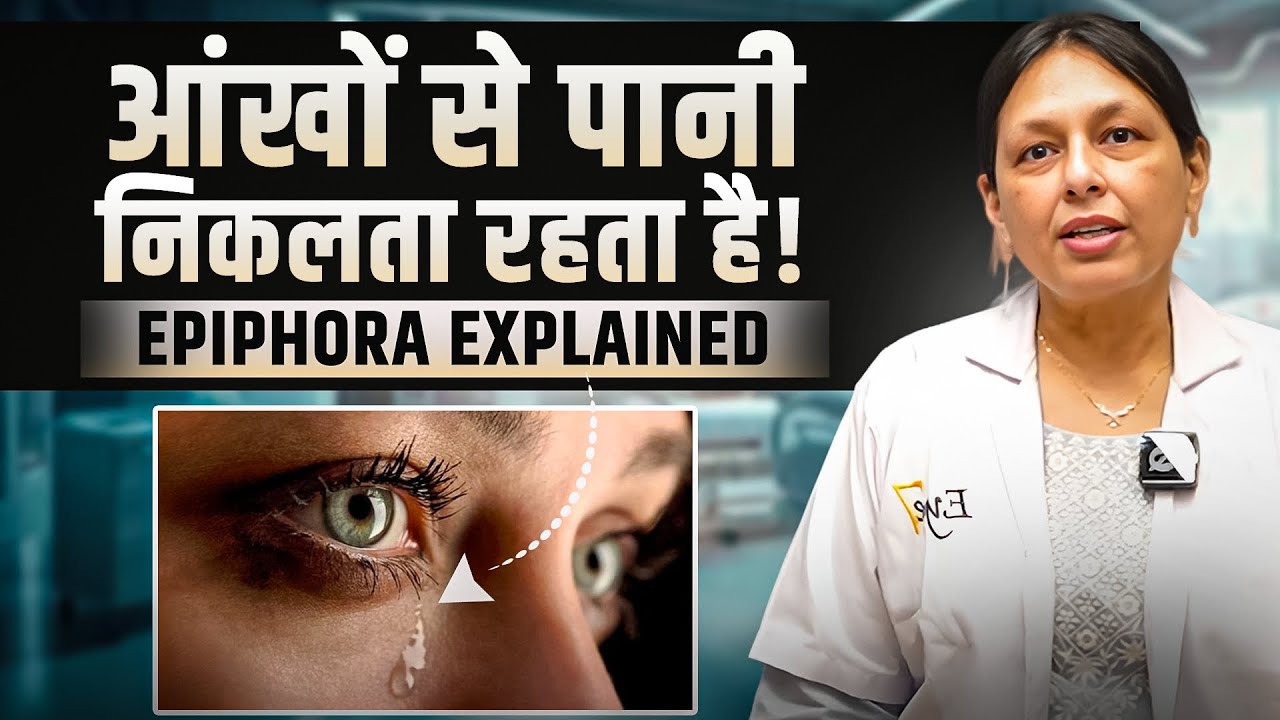 आंखों से पानी निकलता रहता है। Epiphora Explained By Dr. Ruchi - YouTube