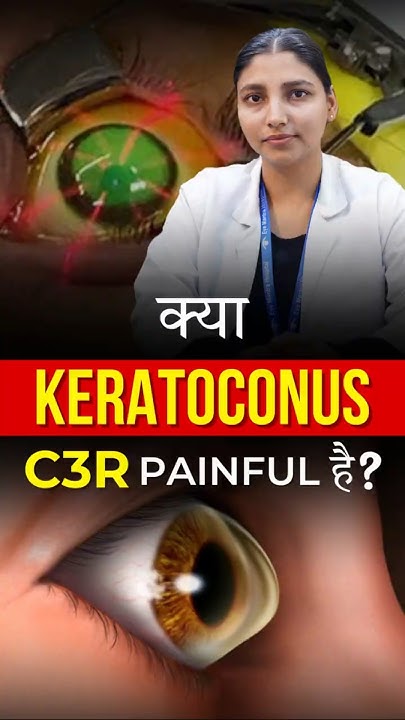 क्या Keratoconus की सर्जरी C3R Painful होती है? - YouTube