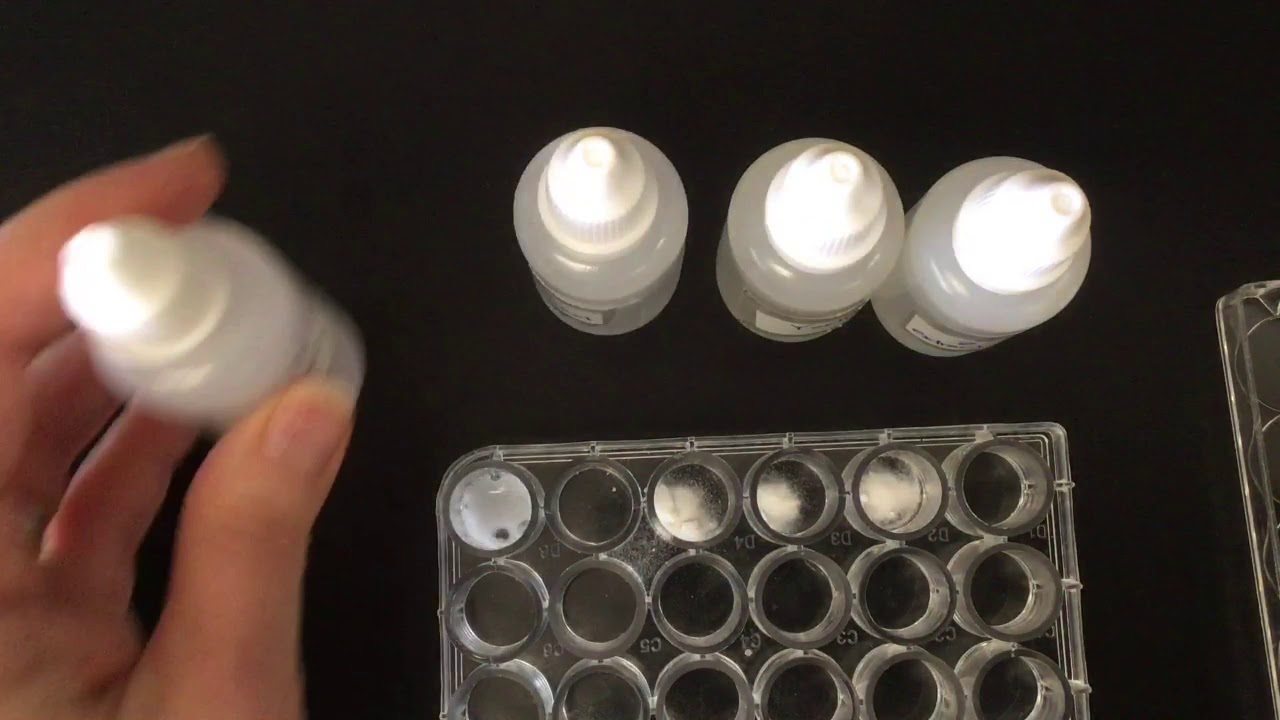 Enzyme M Test for NY Biodiversity Lab - YouTube