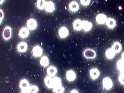 Spirochetes in Live Blood Cell Culture Using CytoViva Enhanced ...