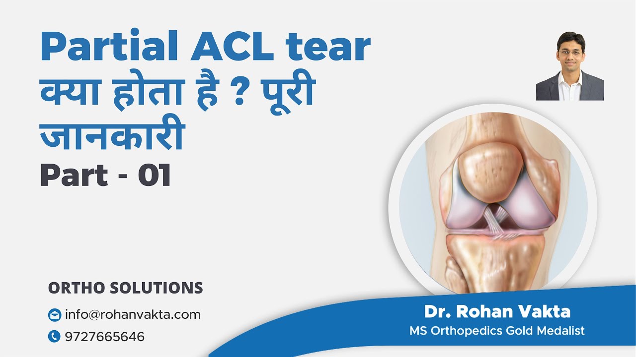 Partial ACL tear क्या होता है ? पूरी जानकारी: Part 1 - YouTube
