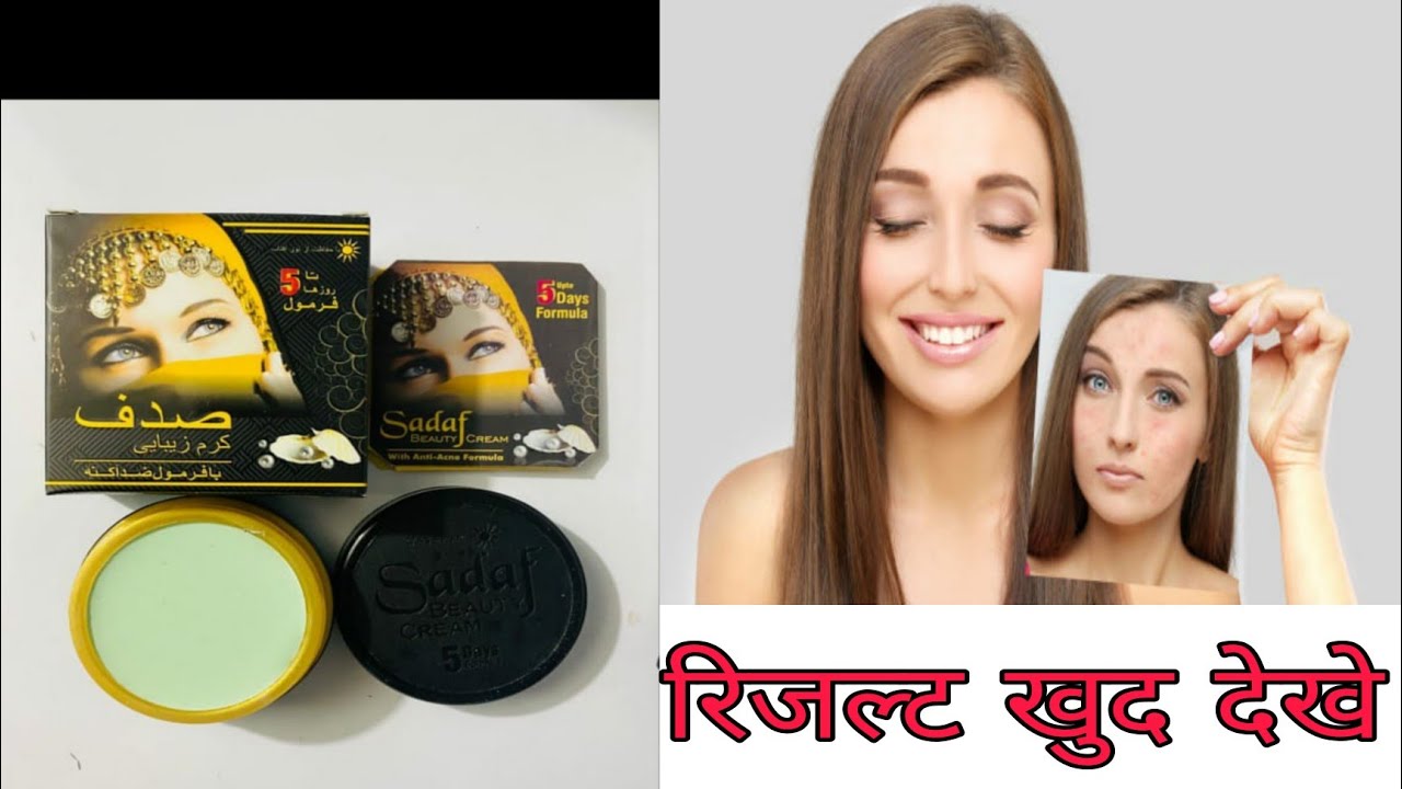 sadaf beauty cream || Acne, pimpals remove || review Hindi..... - YouTube
