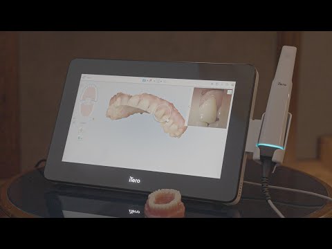 Lighting the way: Align launches Itero Lumina scanner - YouTube