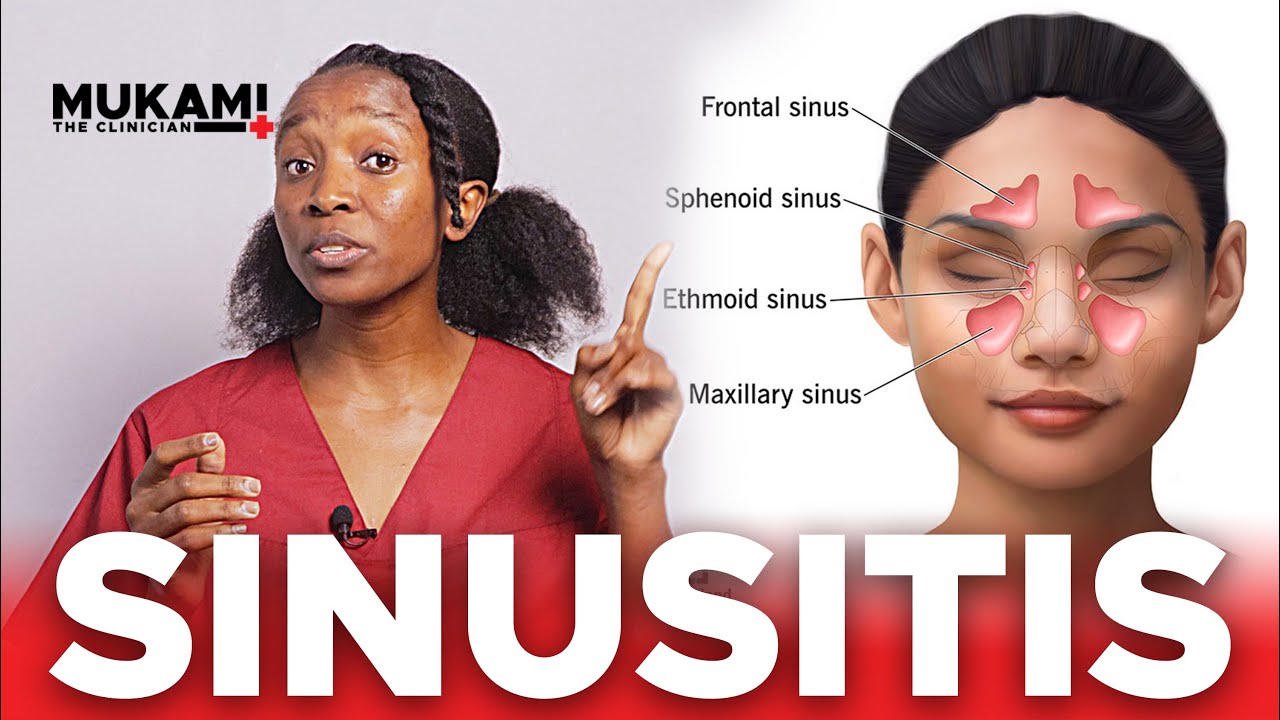 What you mean is Sinusitis, we all have Sinuses - YouTube