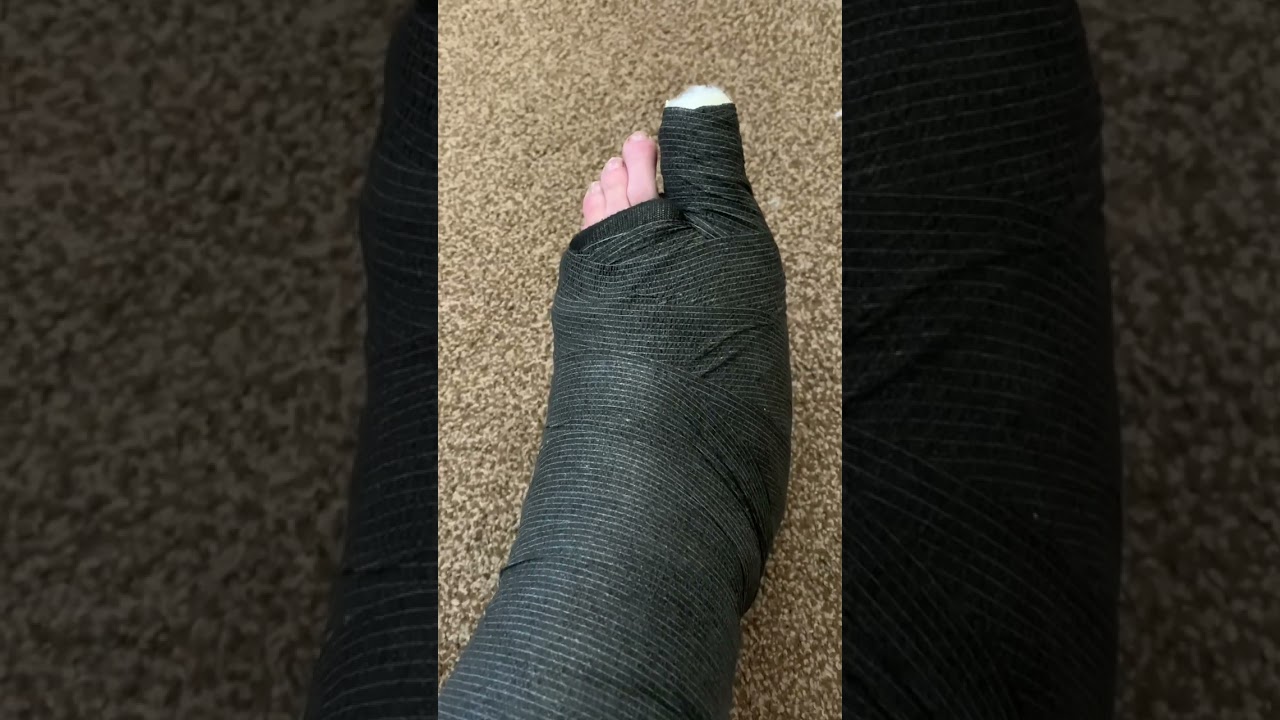 My weekend slwc with toe spica - YouTube