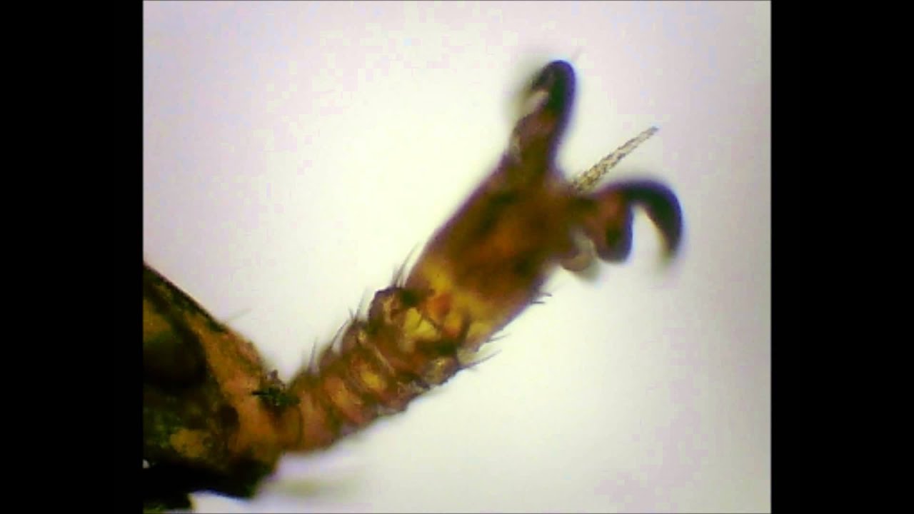Tick recorded under the microscope - YouTube