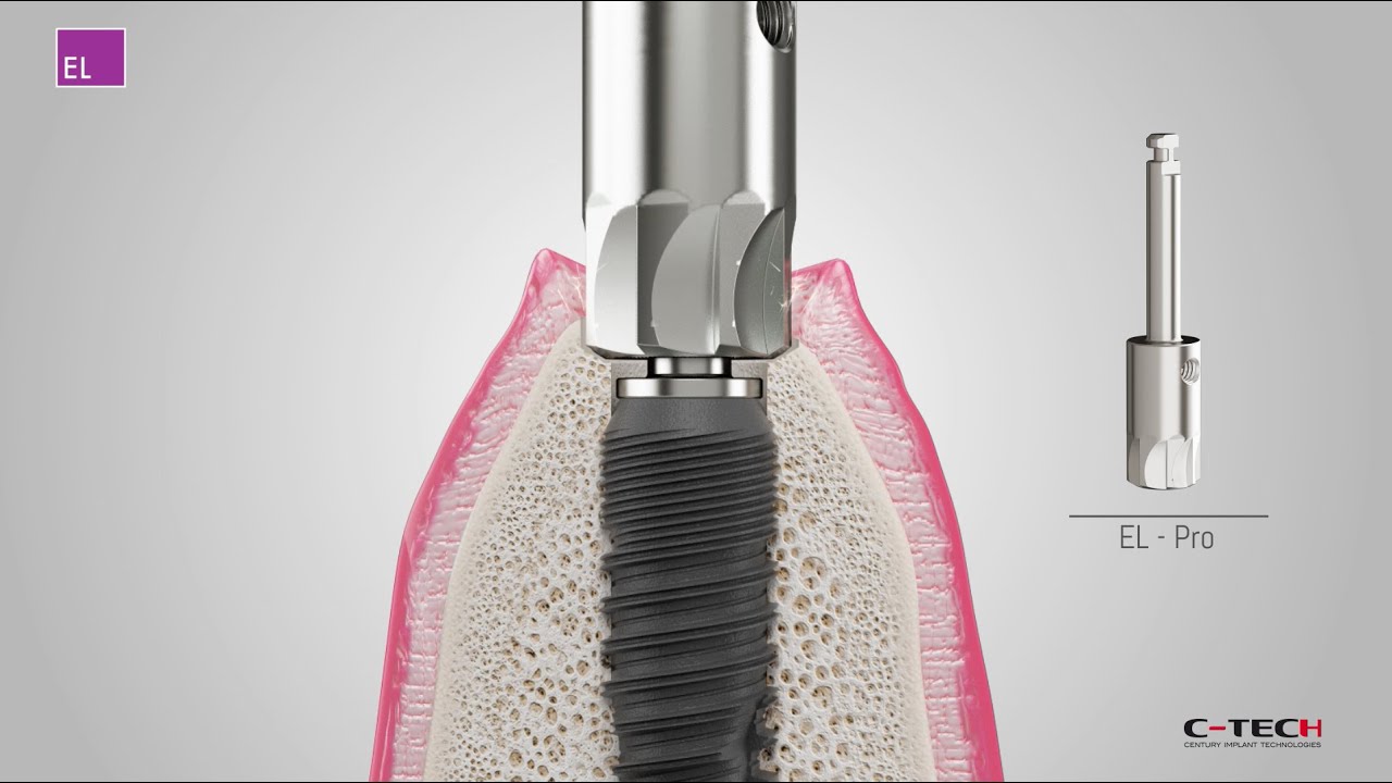 Bone Profiler - YouTube