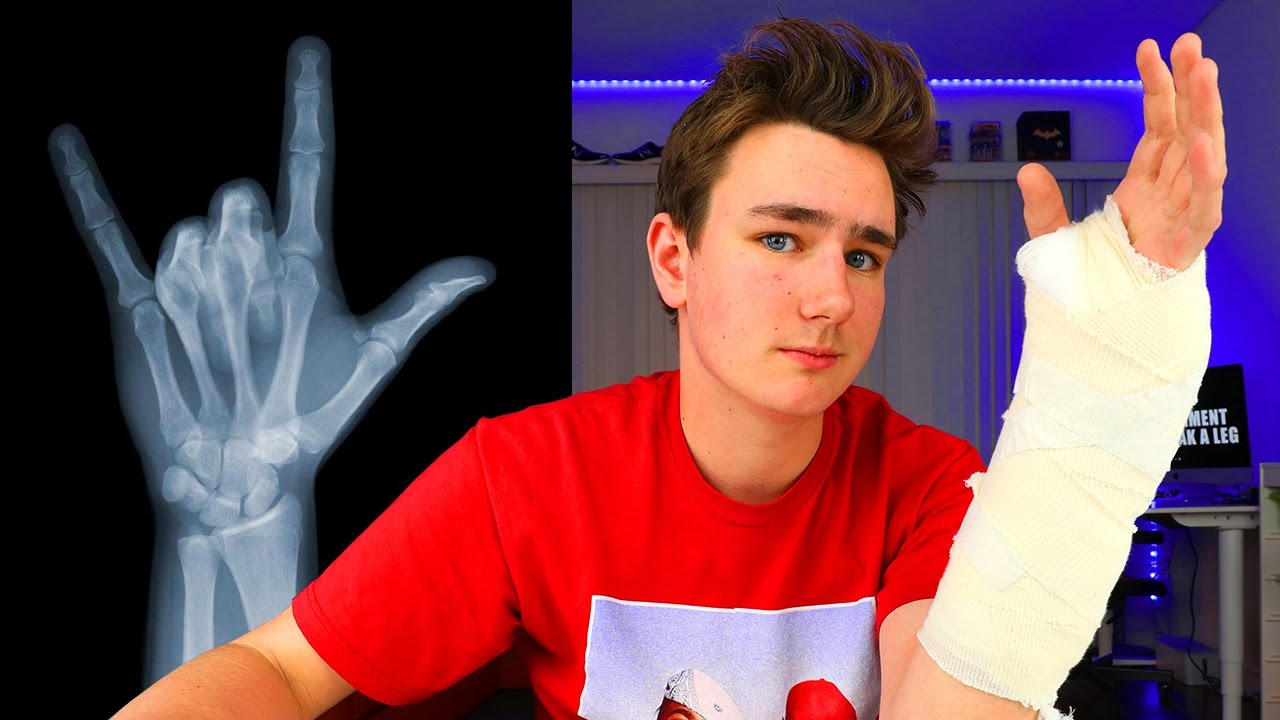 TechSmartt's Hand is way, WAY WORSE - YouTube