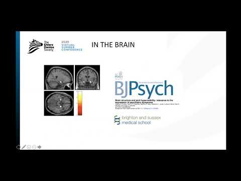 Anxiety and Hypermobility - Dr. Jessica Eccles | English (EN) - YouTube