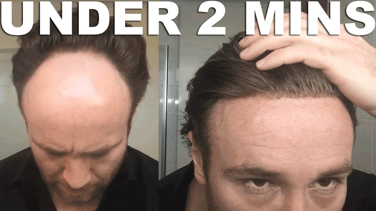 Video 57: Get a FULL HEAD OF HAIR in under 2 minutes - YouTube