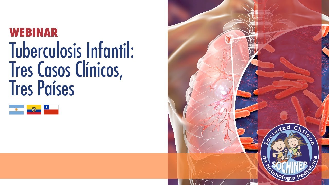 WEBINAR "TUBERCULOSIS INFANTIL: TRES CASOS CLÍNICOS, TRES PAÍSES" - YouTube