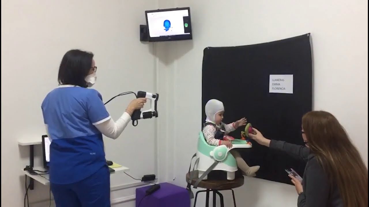 Scanner Vorum 3d: Toma de molde de la órtesis craneal (No invasivo ...