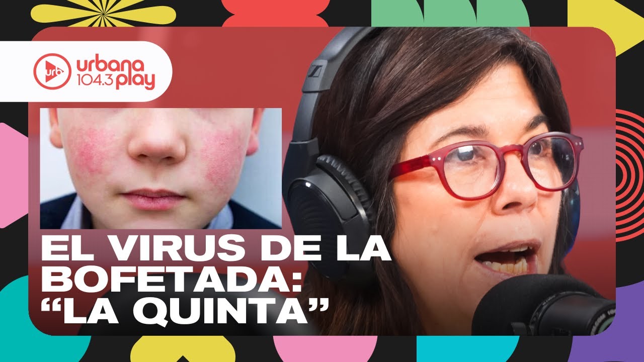 ¿Qué es la "quinta enfermedad" o el "virus de la bofetada" que se ...