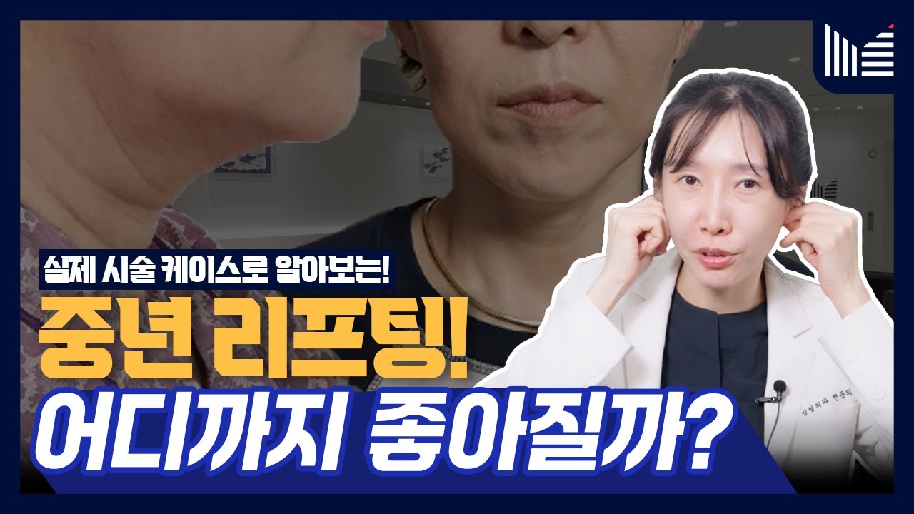 Sub 실제 케이스 리뷰 중년 리프팅 어디까지 좋아질 수 있나요 Youtube