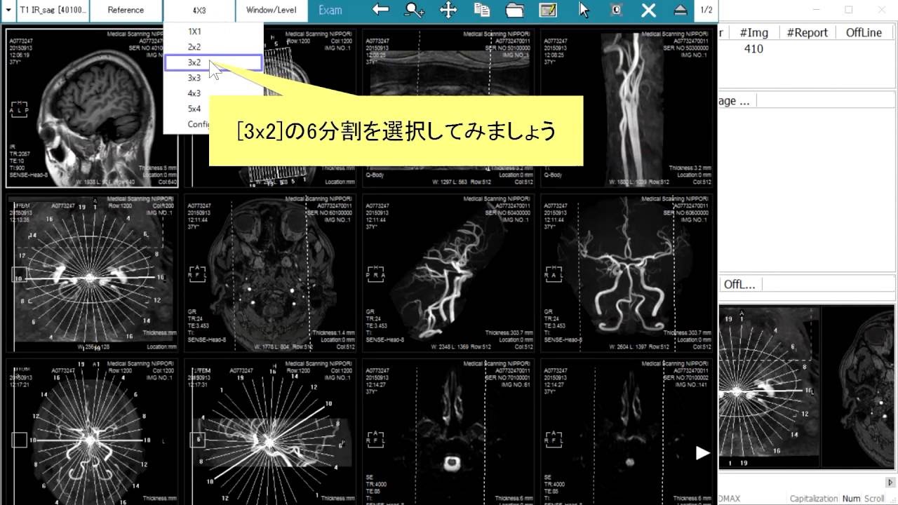 DICOMビューワーの使い方【動画マニュアル】使い方動画 - YouTube