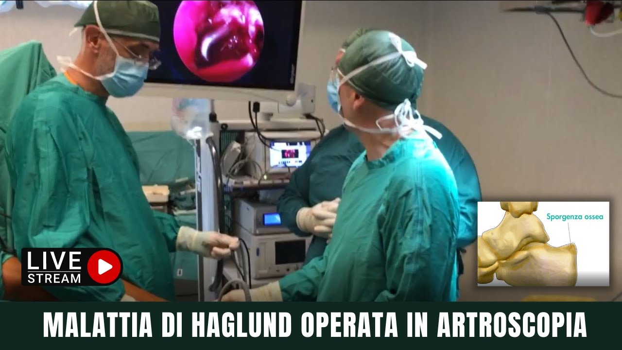 La Malattia di Haglund operata in artroscopia | Morbo di Haglund ...
