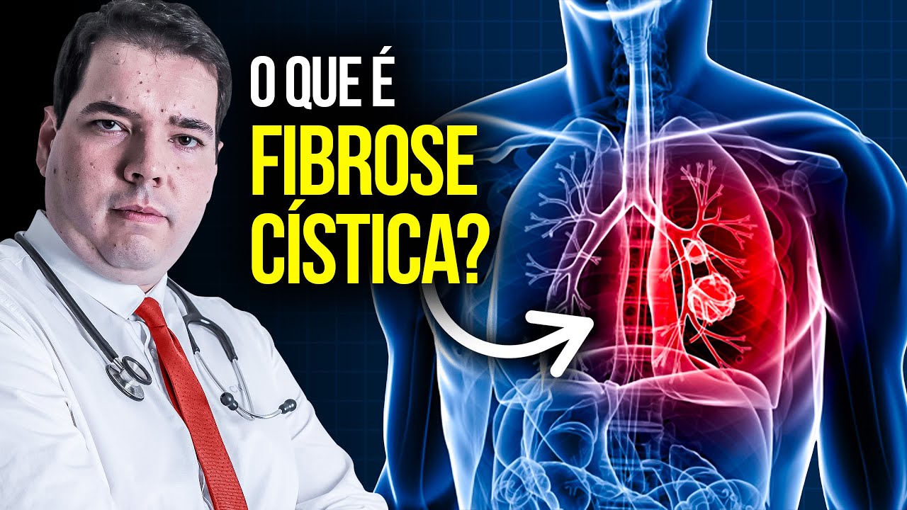 Fibrose Cística - Sintomas e Diagnóstico de Fibrose Cística - YouTube