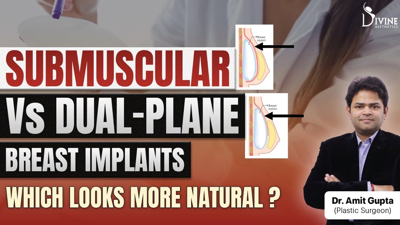 Submuscular vs Dual Plane Breast Implants | Which Looks More Natural ...