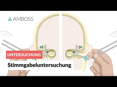 Stimmgabeluntersuchungen nach Rinne und Weber - AMBOSS Video - Rinne-Versuch Weber-Versuch