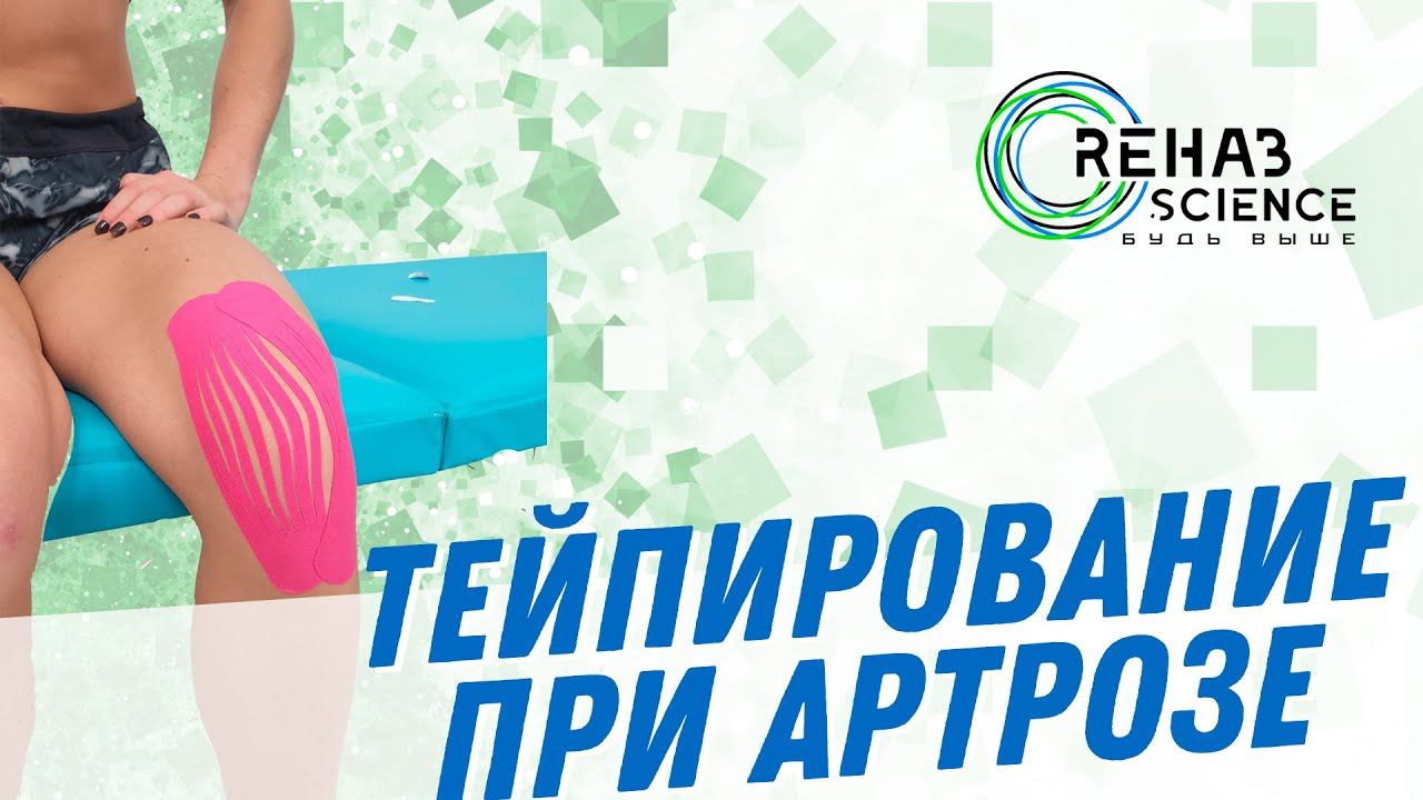 Кинезиотейпирование при артрозе Тейпирование коленного сустава Youtube