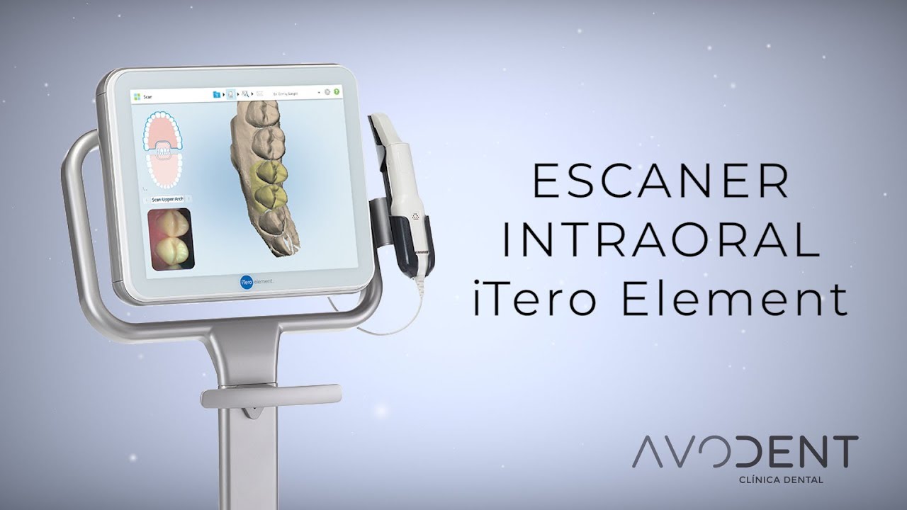 Escáner intraoral iTero Element: ¿qué ventajas tiene? - Clínica dental en Alcobendas Avodent ...