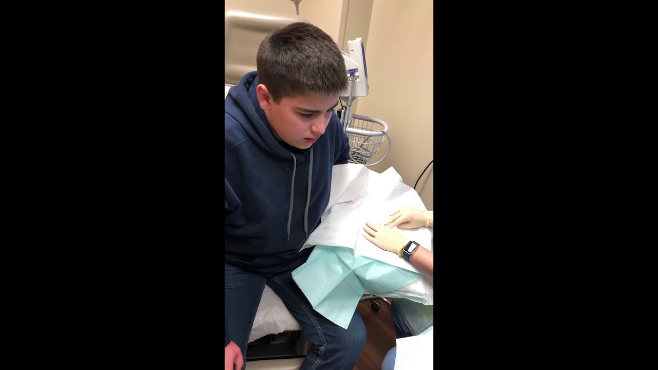 Finger Nail Removal - YouTube