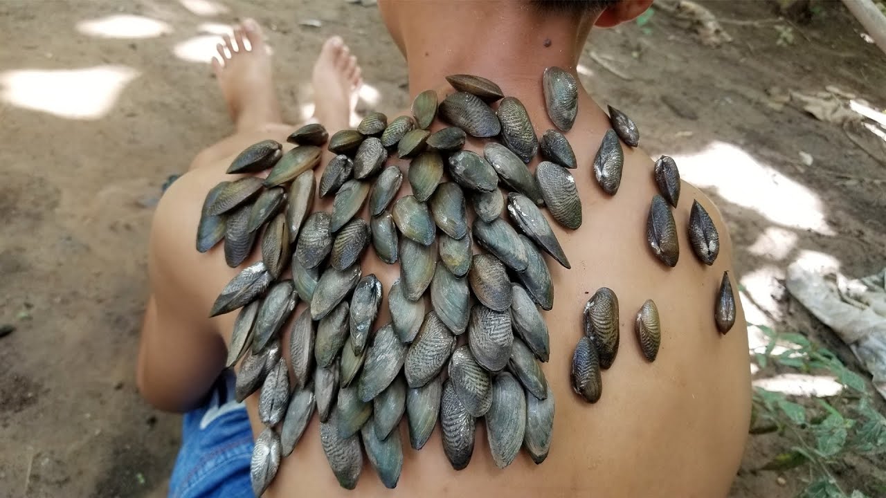 [Remove Ticks] We help remove strange giant ticks on boy's back #223 ...