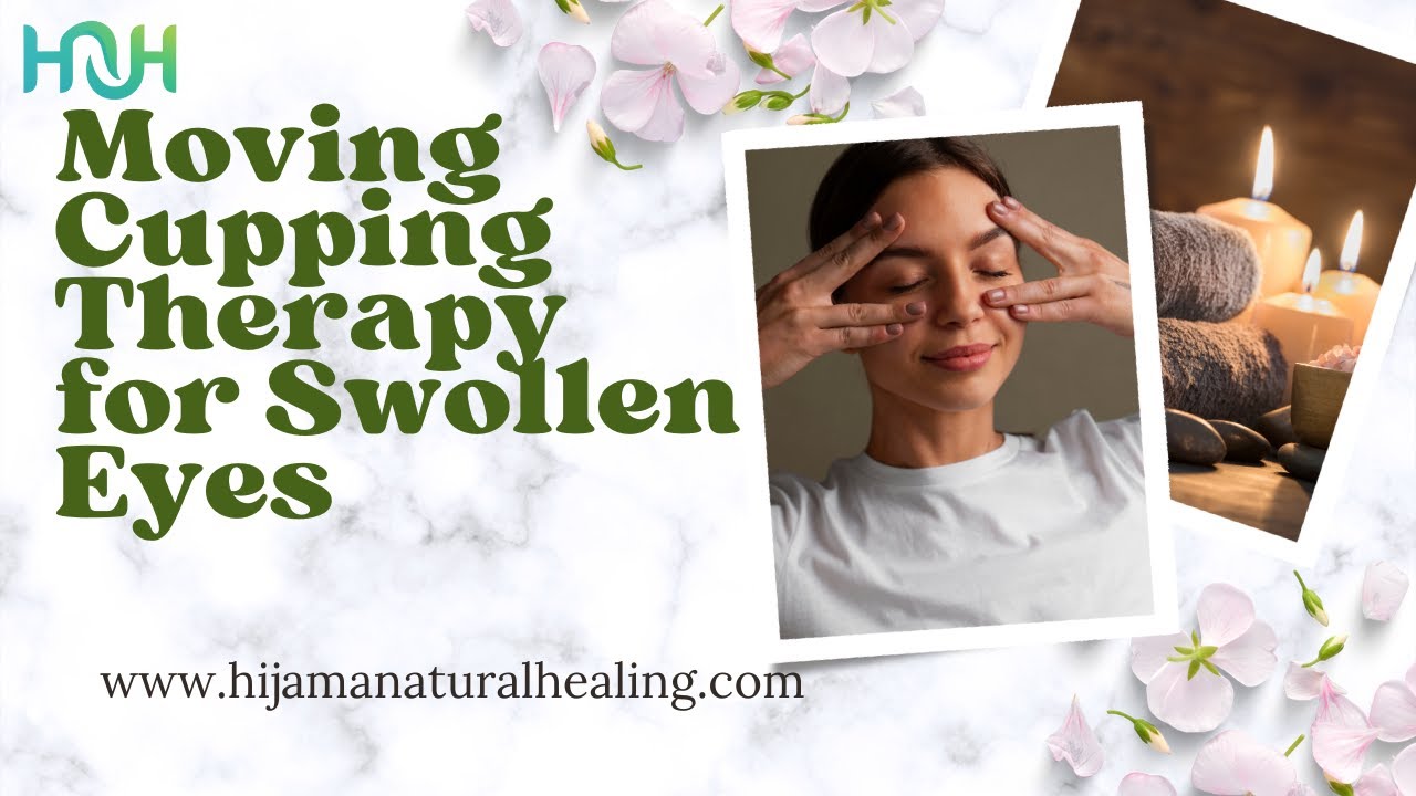 Moving cupping therapy for swollen eyes| Hijama Natural Healing - YouTube