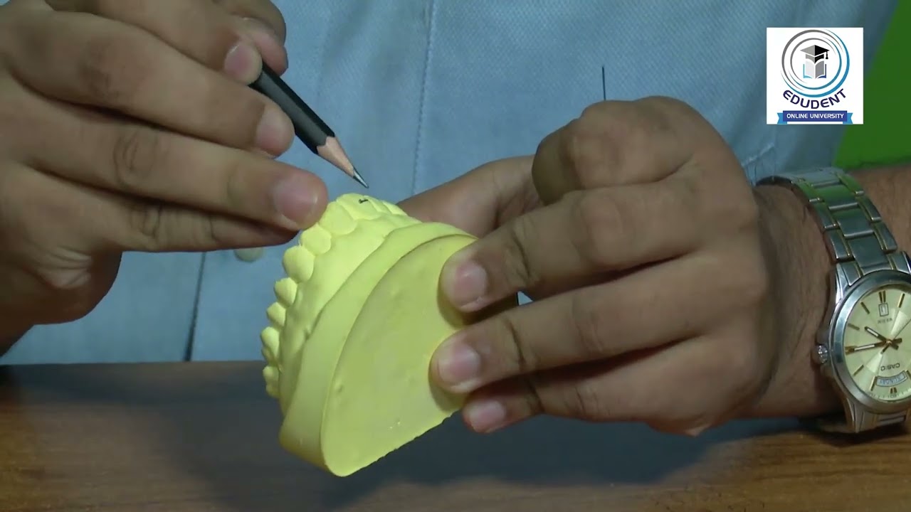 Palatal Finger Spring - YouTube