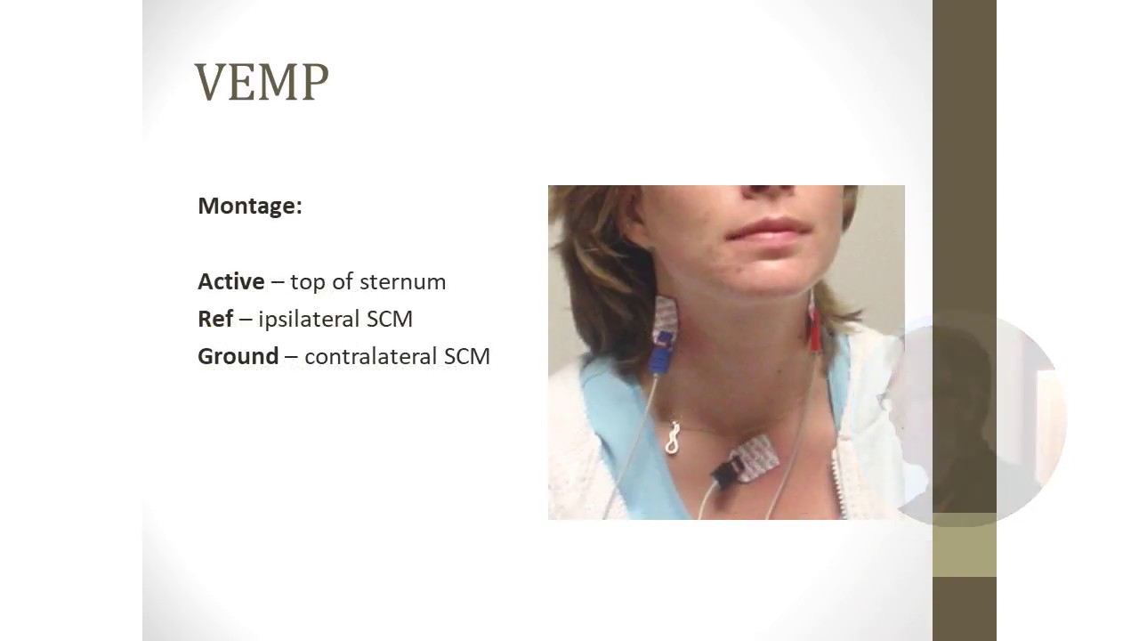 Vestibular Evoked Myogenic Potentials Highlights - YouTube