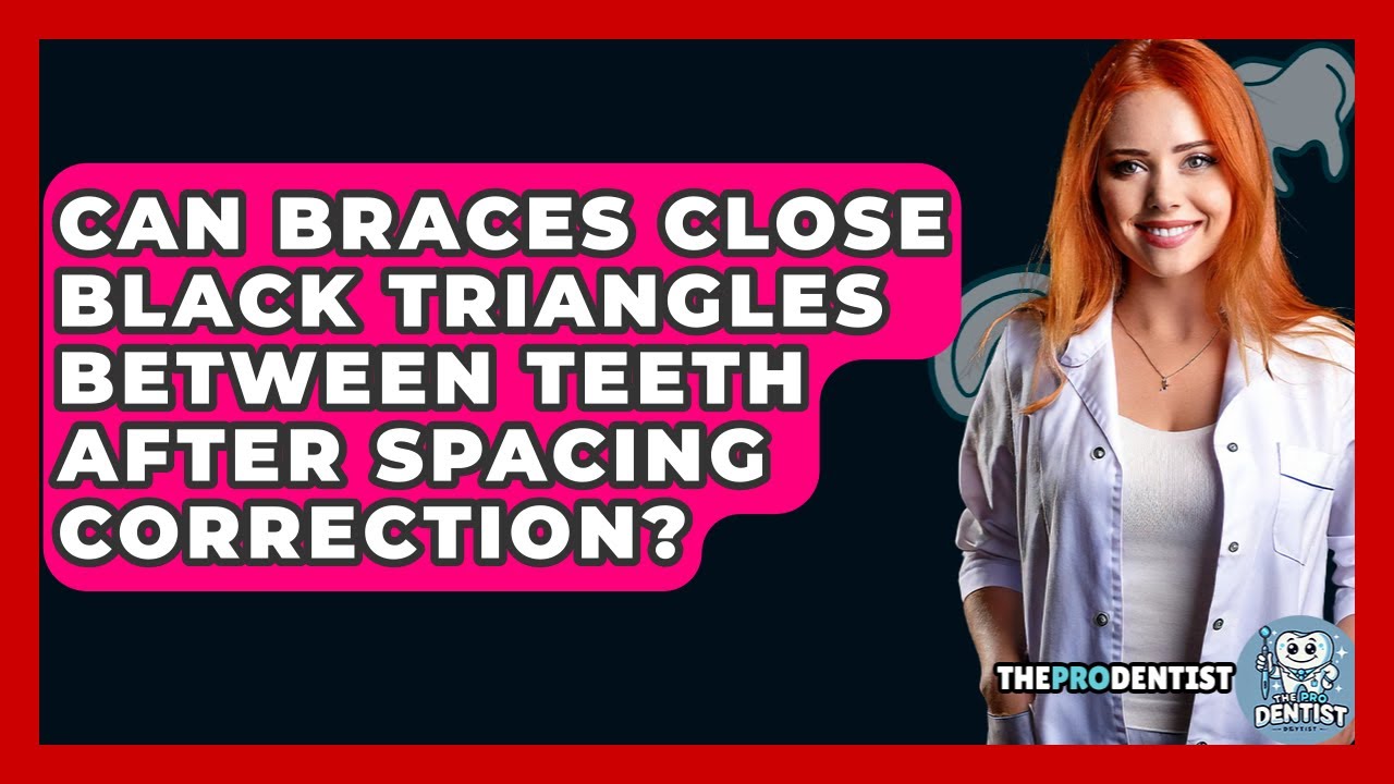 Can Braces Close Black Triangles Between Teeth After Spacing Correction ...