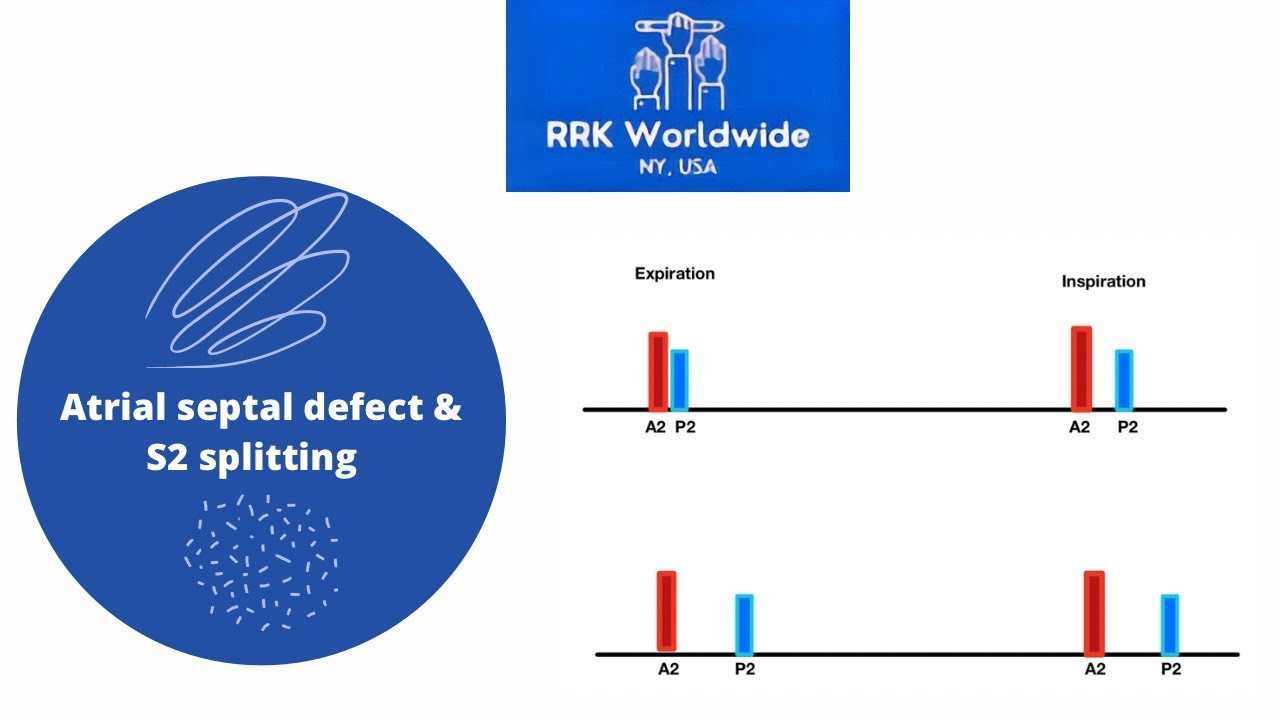 Atrial Septal Defect & S2 Splitting - USMLE - YouTube