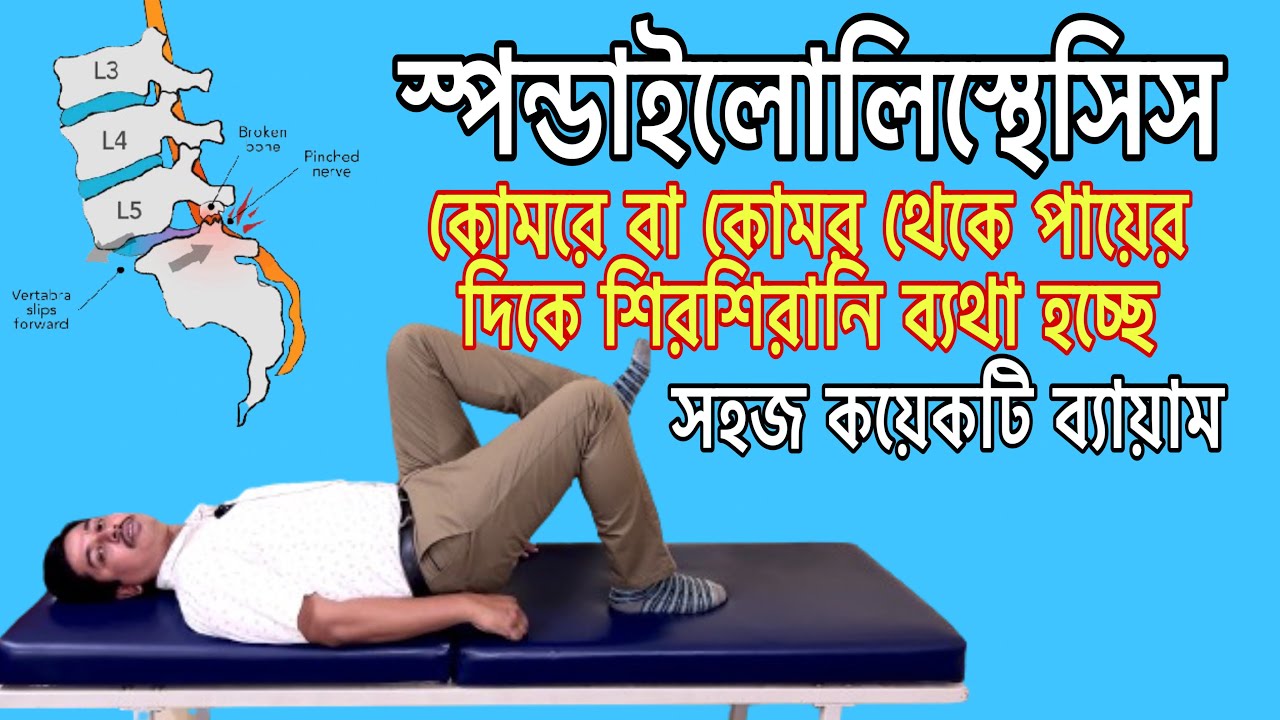 Spondylolisthesis Exercises || L4-L5 , L5-S1 || Back Pain and Leg Pain ...