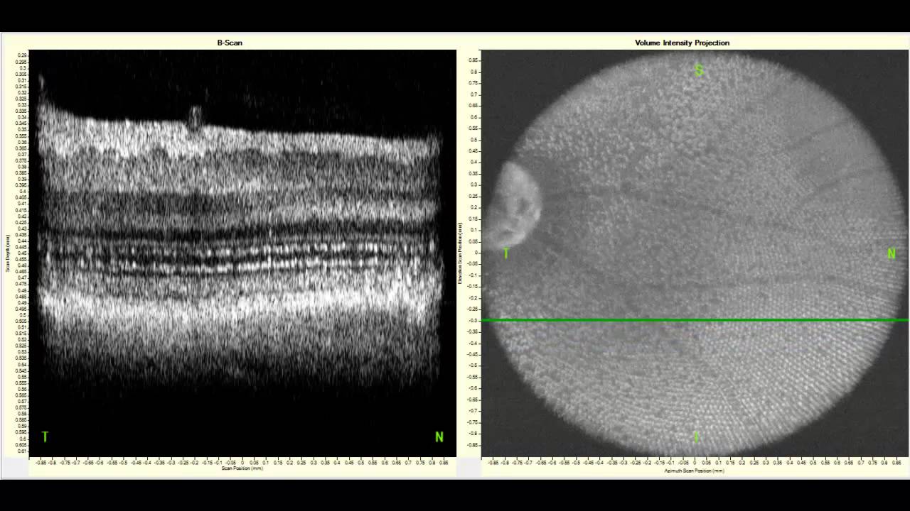 OCT images of a zebrafish using a SuperK supercontinuum light source ...
