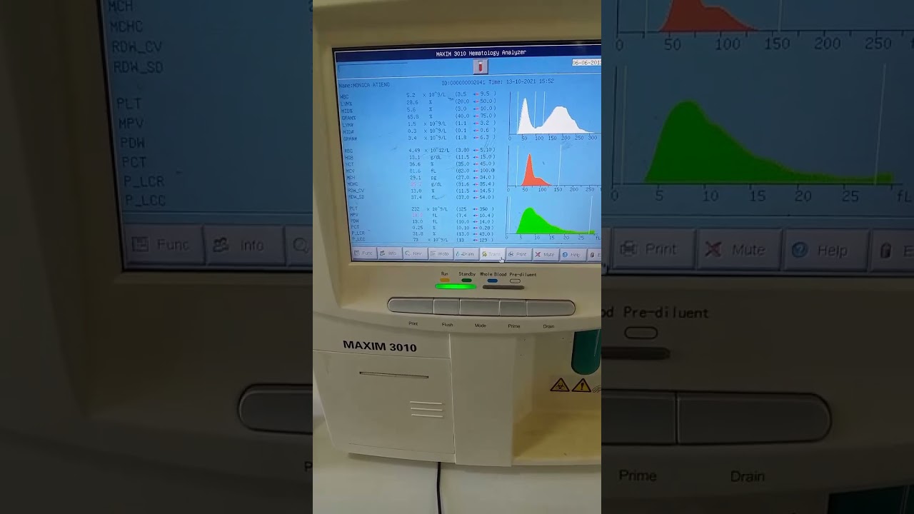 how to run controls in a full haemogram machine maxim 3010 - YouTube