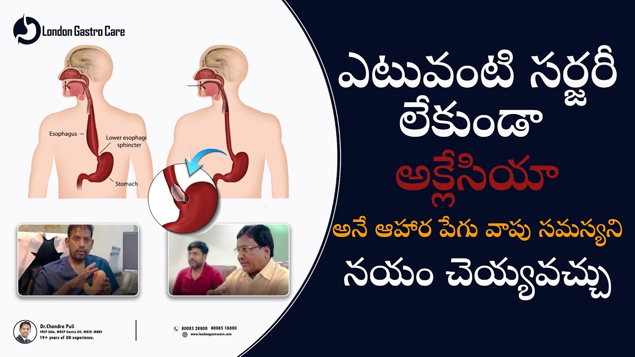 Heavy Burping - vomiting(Thenupulu)| Dr. Chandra Shekhar Puli | London ...