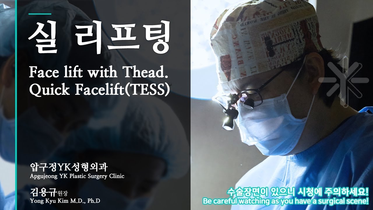 Face lift with Thread. Quick Face lift. TESS lift - YouTube