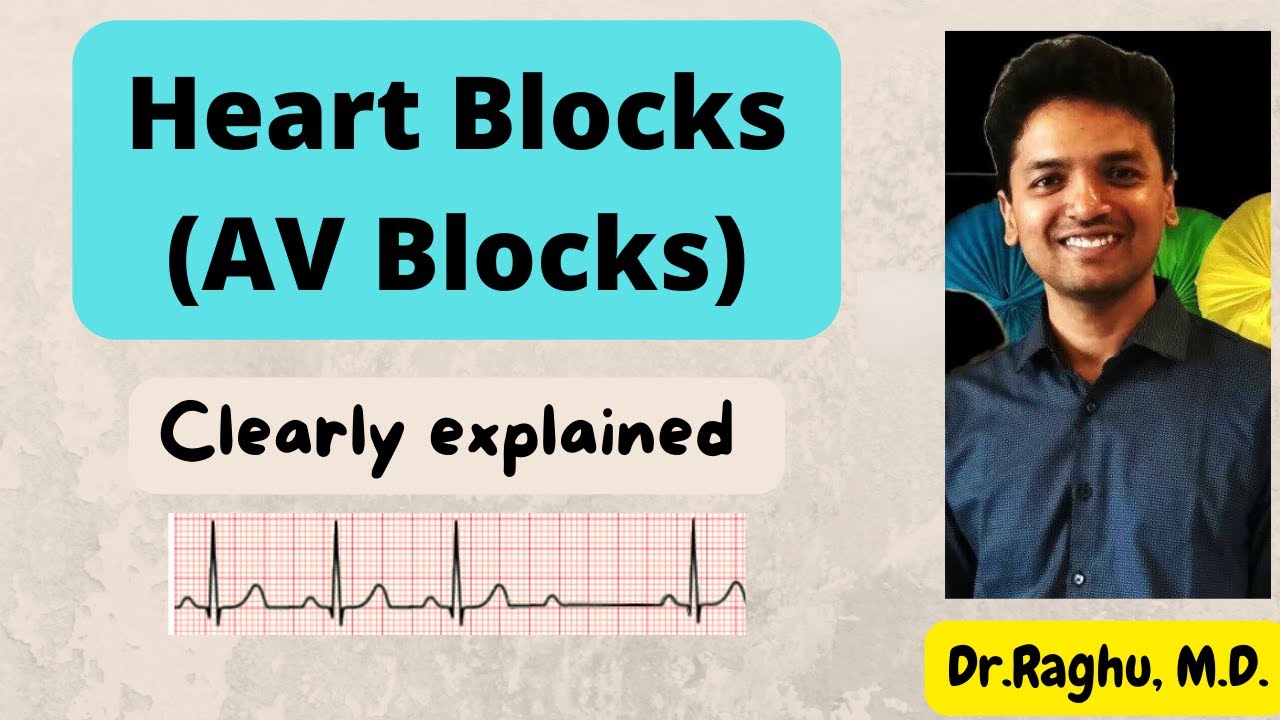 Heart blocks | AV Nodal blocks | Abnormal ECG | Cardiology - YouTube