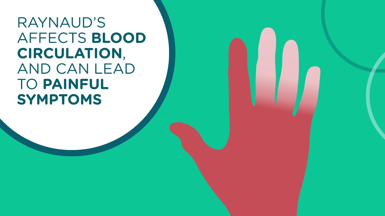 SRUK Raynaud's Awareness Month - YouTube