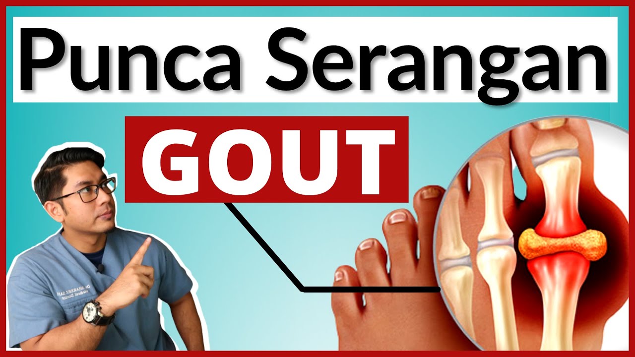 5 Makanan Punca Serangan Gout | Uric Acid Tinggi | Doctor Sani | - YouTube