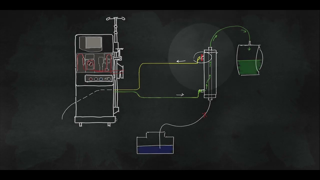 Cleveland Clinic Ultrapure Solution for Continuous Dialysis - YouTube