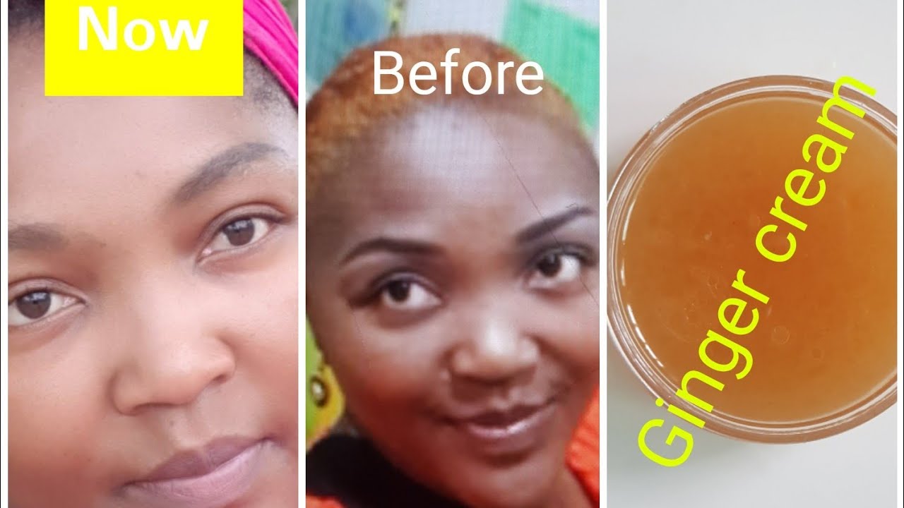 DIY Ginger cream/Removes dark spots, pigmentation/Anti aging ,acnes and ...