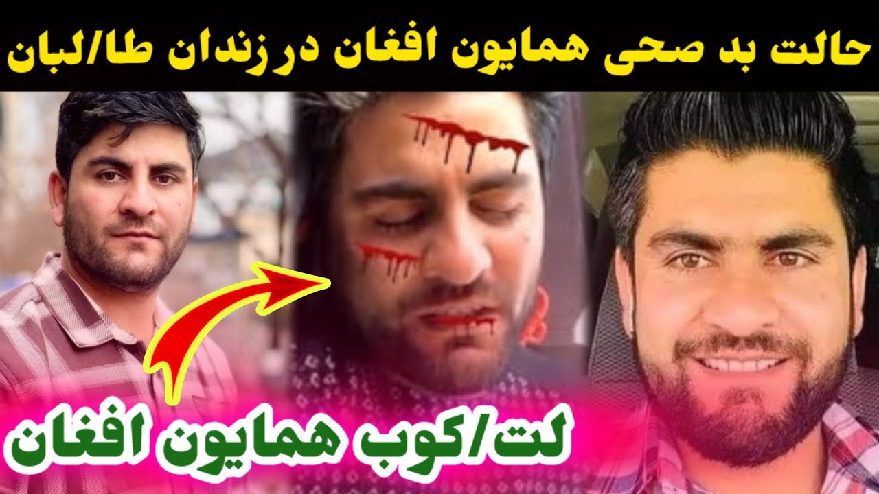 همایون افغان در زندا/ن طالبان و حالت بد همایون افغان /Hamayon Afghan ...