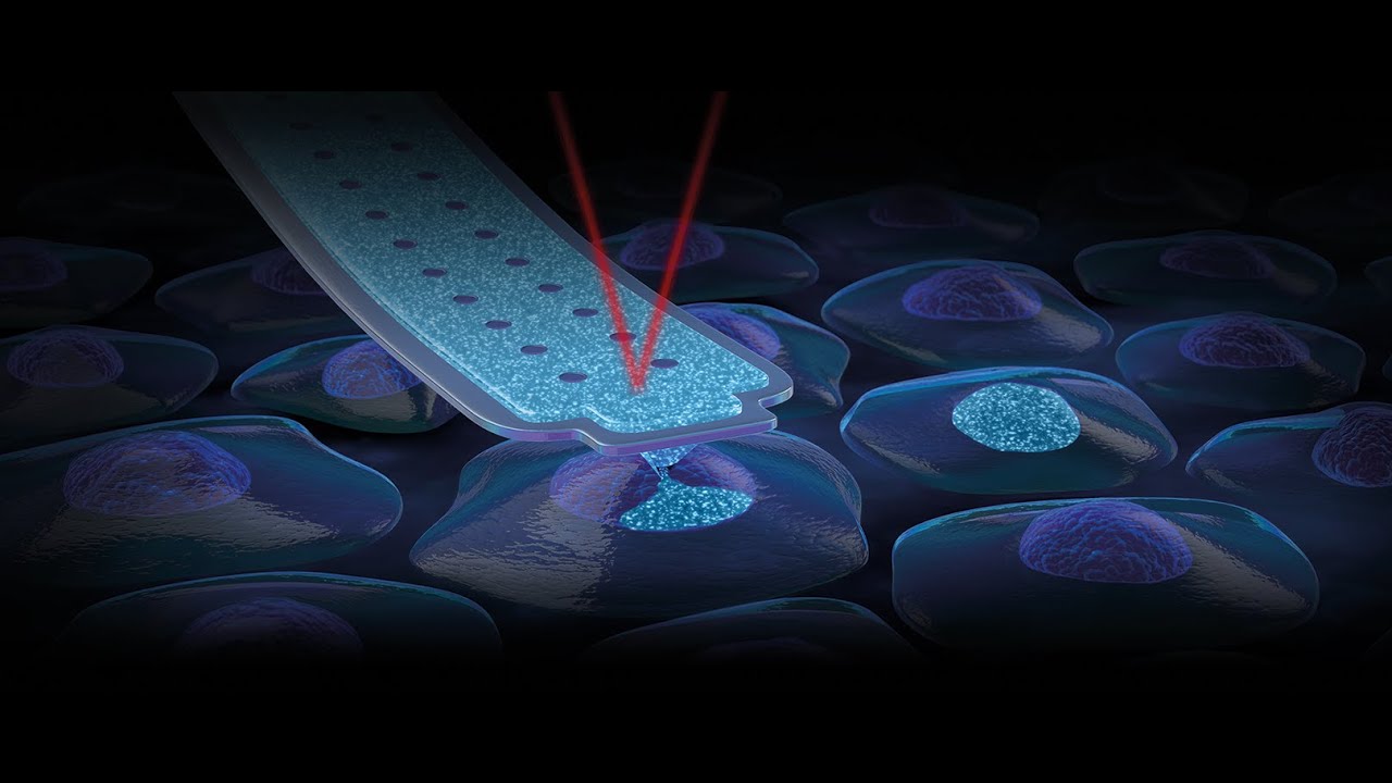 FluidFM BOT BIO Series – Single cell nano-injection into adherent cells ...