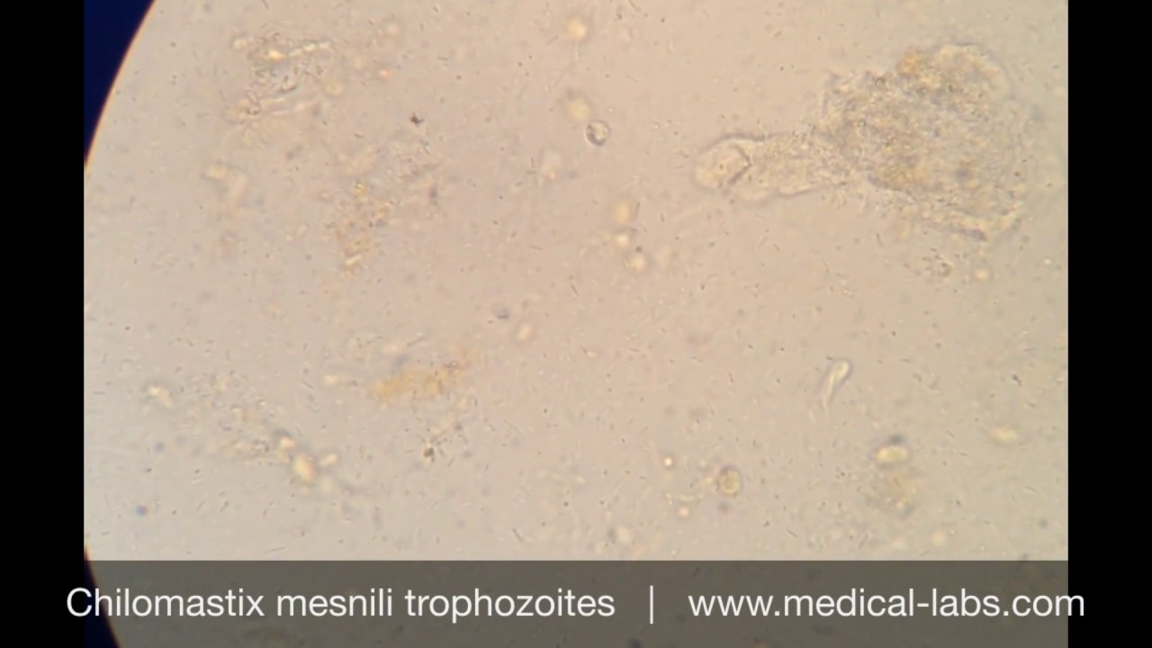 Chilomastix mesnili Trophozoites - YouTube