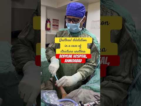 Urethral dilatation in stricture urethra by @drutsavshahurologist  #urethralstricture #urologist