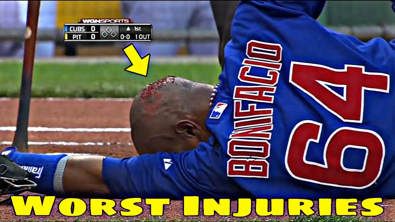 MLB | Worst Injuries - YouTube