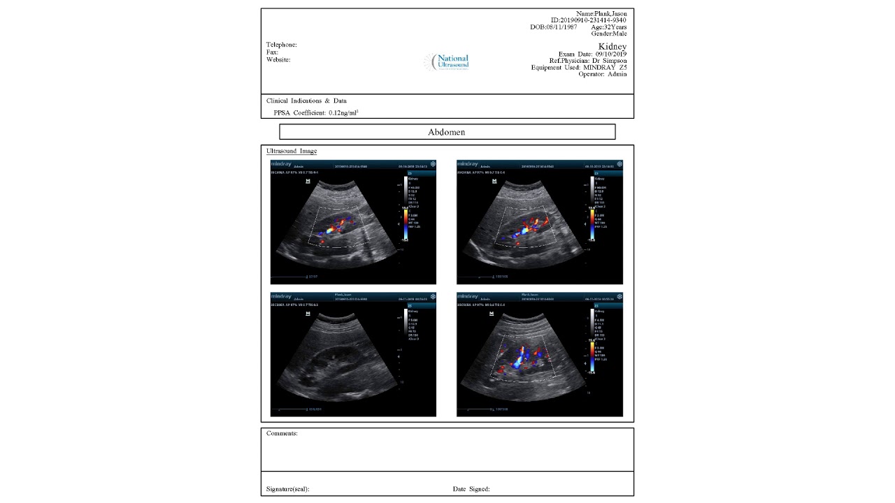 Mindray Z5 Portable Ultrasound Machine Review - YouTube